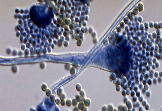 Aspergillus: Un hongo con nombre propio y múltiples caras - SAAeI